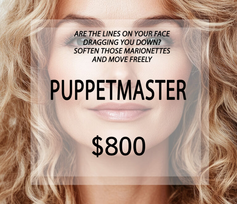Puppetmaster Injections For The Smile Lines | Beauty Lab + Laser